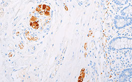 Six Novel Cell Marque IHC Markers — Now Available